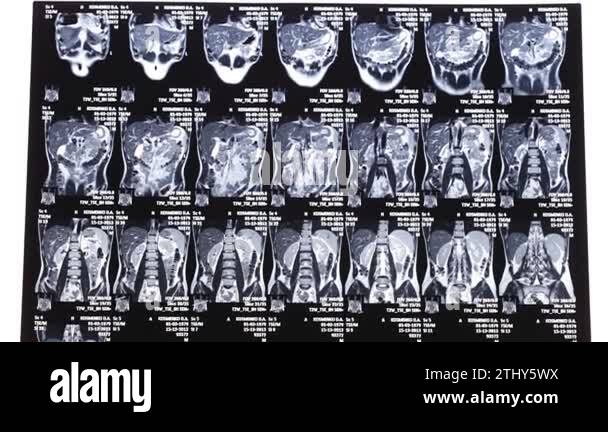 X-rays are a type of electromagnetic radiation, just like visible light ...