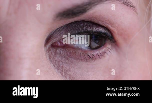 Senior woman eye with moving brown pupil and red veins closeup ...