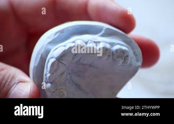 Orthodontist holding tooth imprint and dental splint with his hands for ...