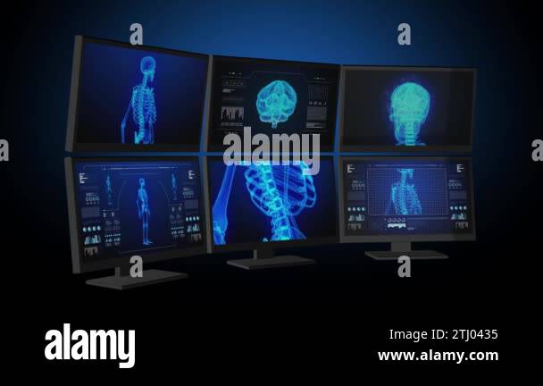 Medical computers workstation. Animated infographics. 3d images. 4K ...