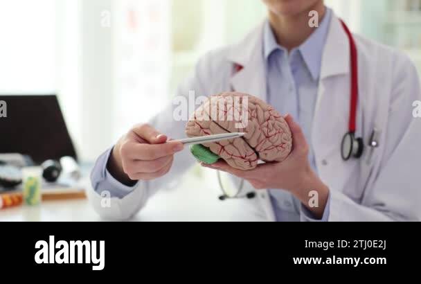 doctor holds artificial model of human brain closeup. Dementia syndrome ...