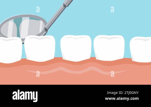 Cartoon healthy teeth inspection with mirror. Caries on the tooth ...
