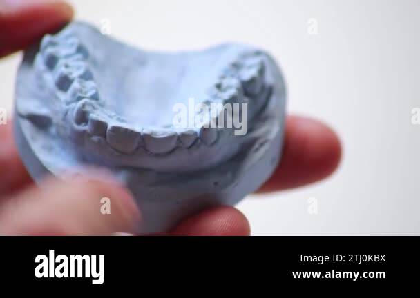 Orthodontist holding tooth imprint and dental splint with his hands for ...