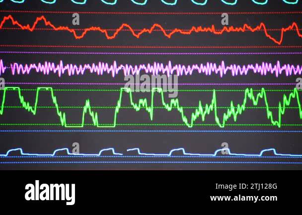 Modern patient monitor. Electronic Health Monitor displaying medical ...