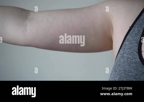 Light-skinned young woman with drooping arms. Sad bad body shape girl ...