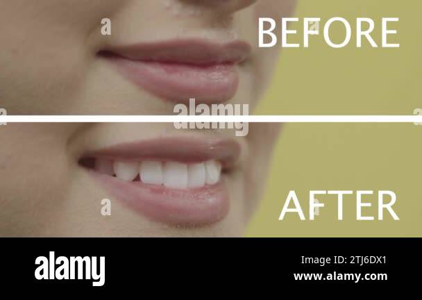 Dental care and dentistry concept. Close-up of happy Caucasian woman ...