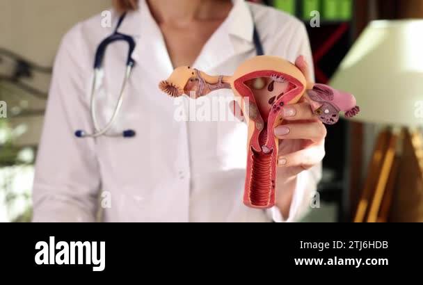 Doctor holds artificial model of uterus in hand showing thumb up ...