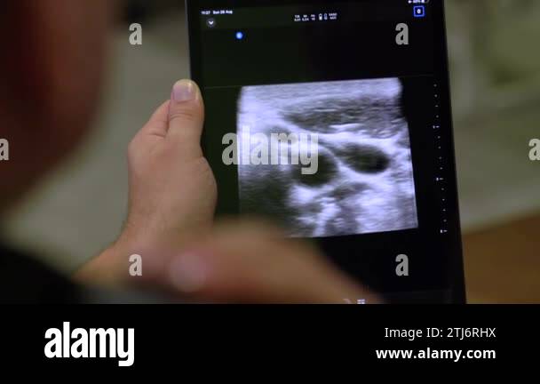 Doctor diagnoses a man in the neck with an ultrasound scanner, makes an ...