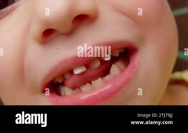 Tooth change Stock Videos & Footage - HD and 4K Video Clips - Alamy