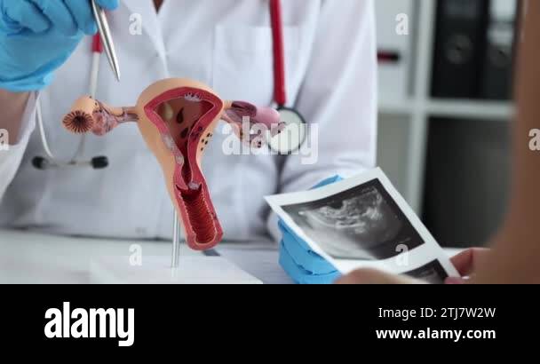 Gynecologist shows the anatomy of uterus and an x-ray of woman ...