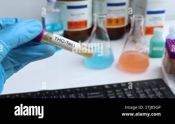 Urine samples for testing THC in the laboratory, urine sample in test ...