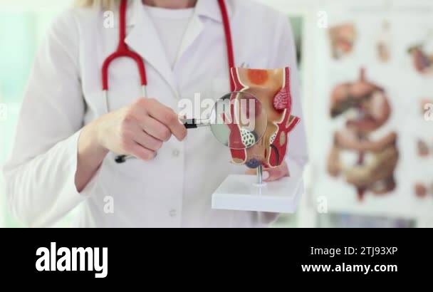 Proctologist is holding magnifying glass and anatomical model of rectum ...