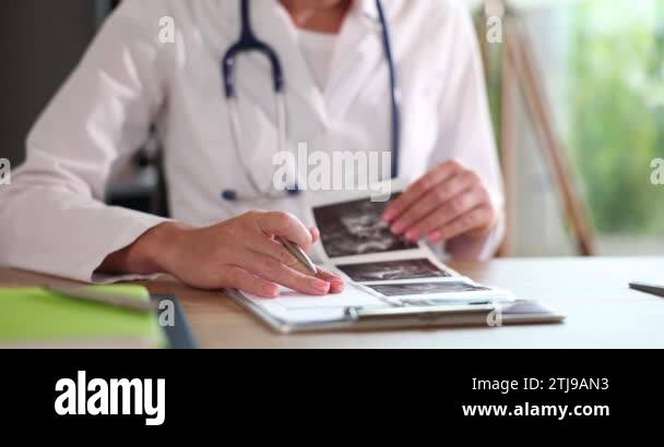 Female doctor holds results of ultrasound scan of uterus in hands ...