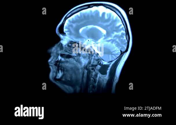 Human brain scan mri health Stock Videos & Footage - HD and 4K Video ...