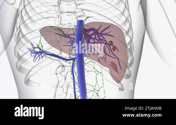 Several types of cancer can form in the liver. The most common type of ...