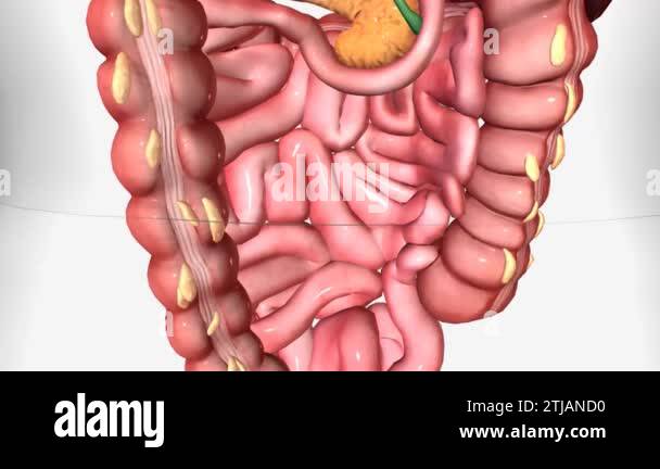 Healthy colon endoscopy Stock Videos & Footage - HD and 4K Video Clips ...