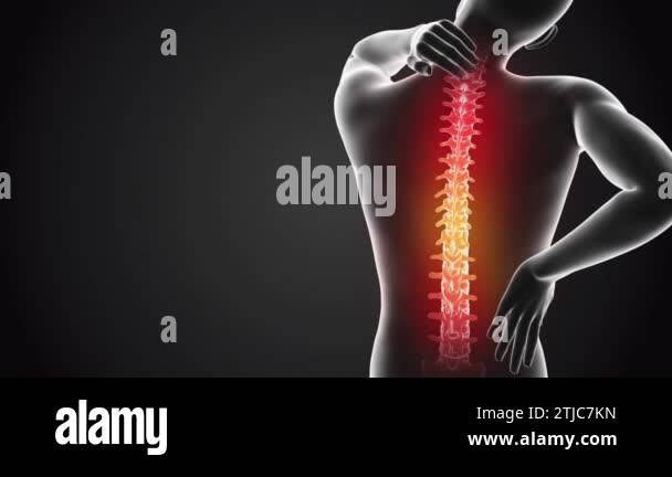 Animation background of painful back VFX Back Pain Augmented Reality ...
