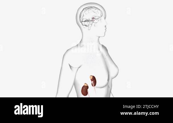 Pituitary Gland Disorder Stock Videos And Footage Hd And 4k Video Clips Alamy