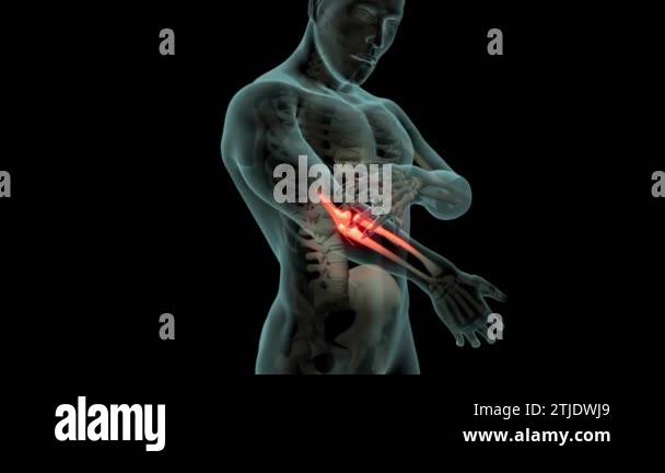 Back Pain spinal spine close-up animation Anatomy Body 3D Scan render ...