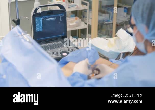 Surgical treatment of varicose veins of the lower extremities in the ...