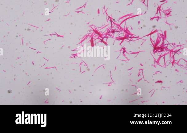 Dermal pathology Stock Videos & Footage - HD and 4K Video Clips - Alamy