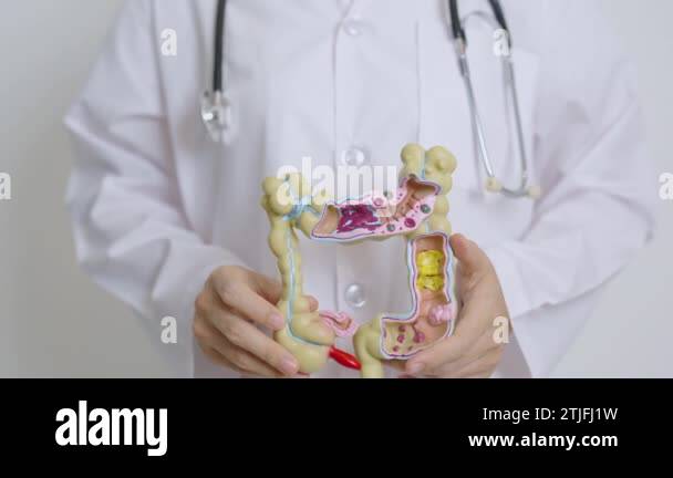 Colon intestine cancer Stock Videos & Footage - HD and 4K Video Clips ...