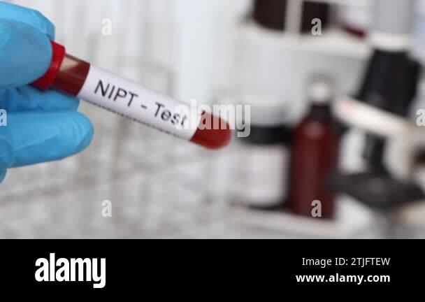 NIPT test to look for abnormalities from blood, blood sample to analyze ...