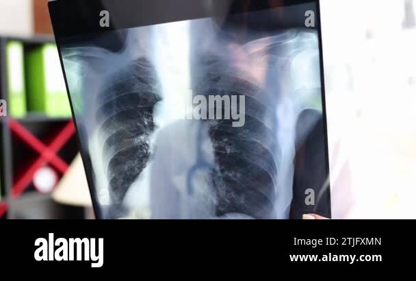 A doctor with an x-ray in his hands, a close-up. Diagnostics by a ...