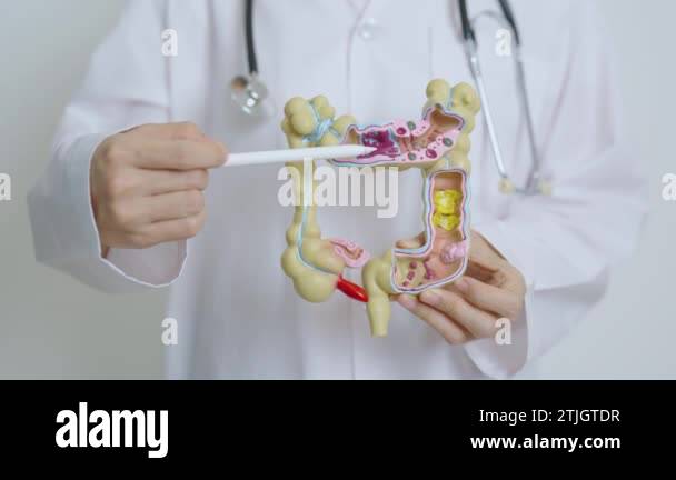 Doctor with human Colon anatomy model and tablet. Colonic disease ...