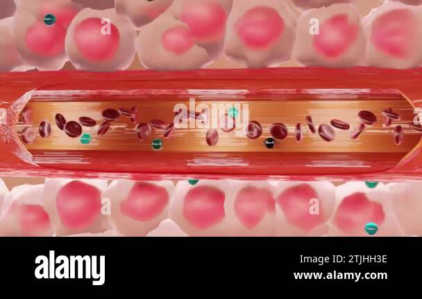 Anemic Hypoxia, hypoxic, stagnant, histotoxic, arterial pO2 and O2 ...