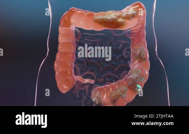 Anatomy of the human digestive system, concept of the intestine, alpha ...