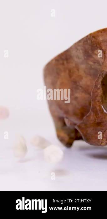 real human skull in section next to the wisdom teeth of real people ...