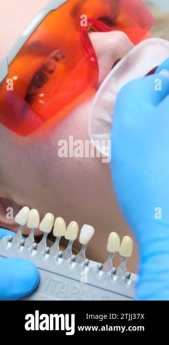 classical dental coloring for determining color of teeth Banner tooth ...