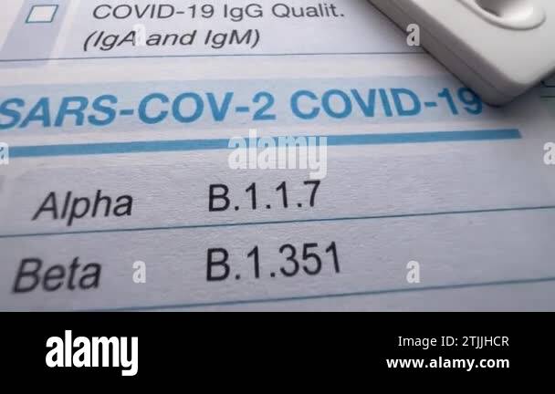 Antigen test kit for the detection of COVID-19 Sars-Cov-2 virus ...