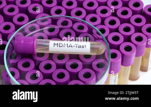 Urine samples for testing MDMA in the laboratory, urine sample in test ...