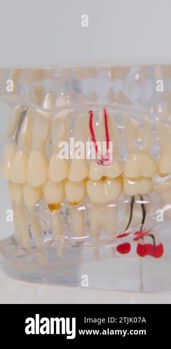 Mock-up Jaws on white background reflection teeth skeleton plastic ...