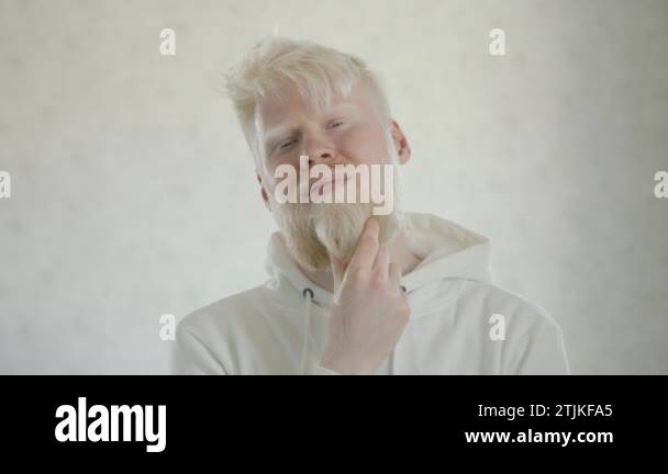 Medium close up of thoughtful albino man posing for camera on white ...