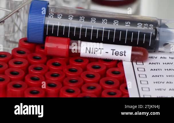 NIPT test to look for abnormalities from blood, blood sample to analyze ...