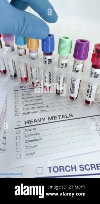 Lab technician holding a blood testing over requisition report for ...