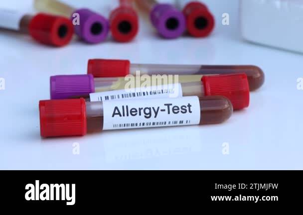 Allergy test to look for abnormalities from blood, blood sample to ...