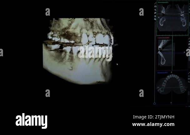 3d computer imaging Stock Videos & Footage - HD and 4K Video Clips - Alamy