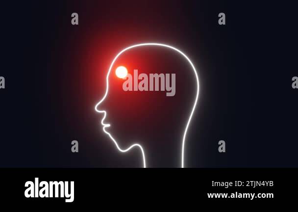 Headache Migraine Human head silhouette with red glowing acute pain ...