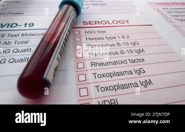 Blood list Stock Videos & Footage - HD and 4K Video Clips - Alamy