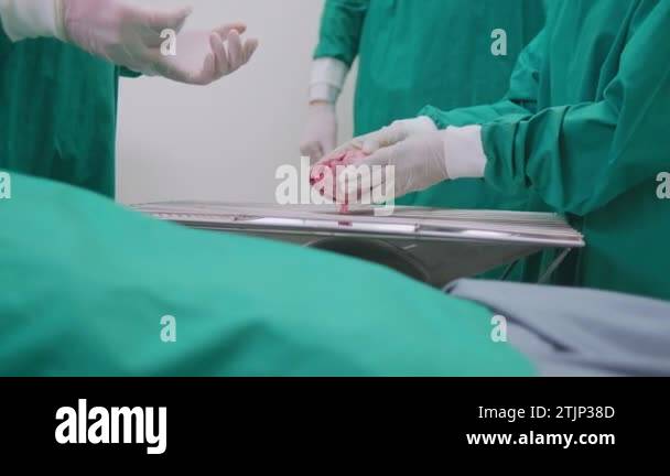 Surgery operations Stock Videos & Footage - HD and 4K Video Clips - Alamy