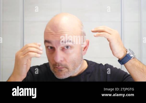 Bald man scared of losing hair.Male person looking at himself in the ...