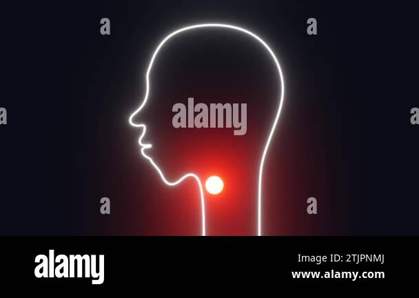 Sore throat concept. Human head silhouette with red glowing acute ...