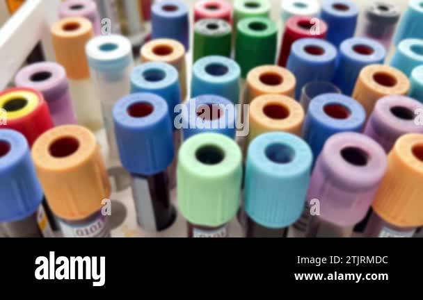 blurred background with Blood Tubes test with biological samples in ...