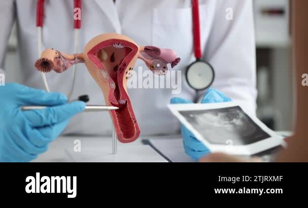 The doctor points with a pen to the anatomical model of the female ...