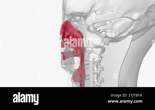 Epistaxis (also called a nosebleed) refers to a minor bleeding from the ...