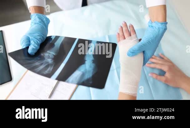 Doctor holds x-ray of hand and examines patient sore arm. Stretching ...